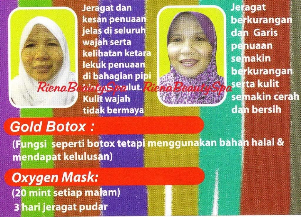 BOTOX..TEGANG..LICIN.. SHAKILA skin care sudah TERBUKTI!! | CariGold Forum